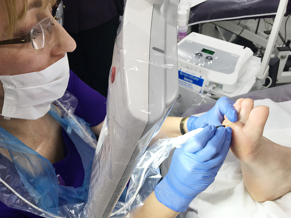 Electrolysis Machine & Hair Removal Machines | Sterex